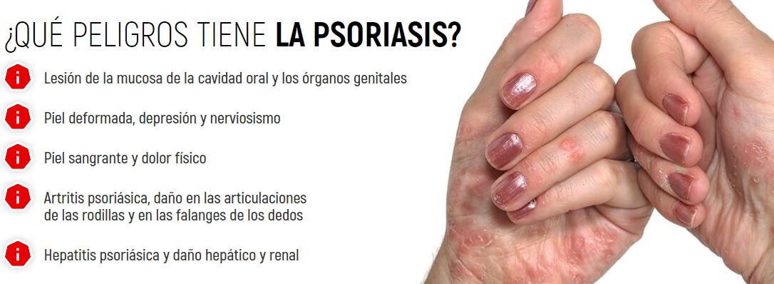 Psorilin: La única crema con nanotecnología ¿Dónde comprarla? ¿Precio ...