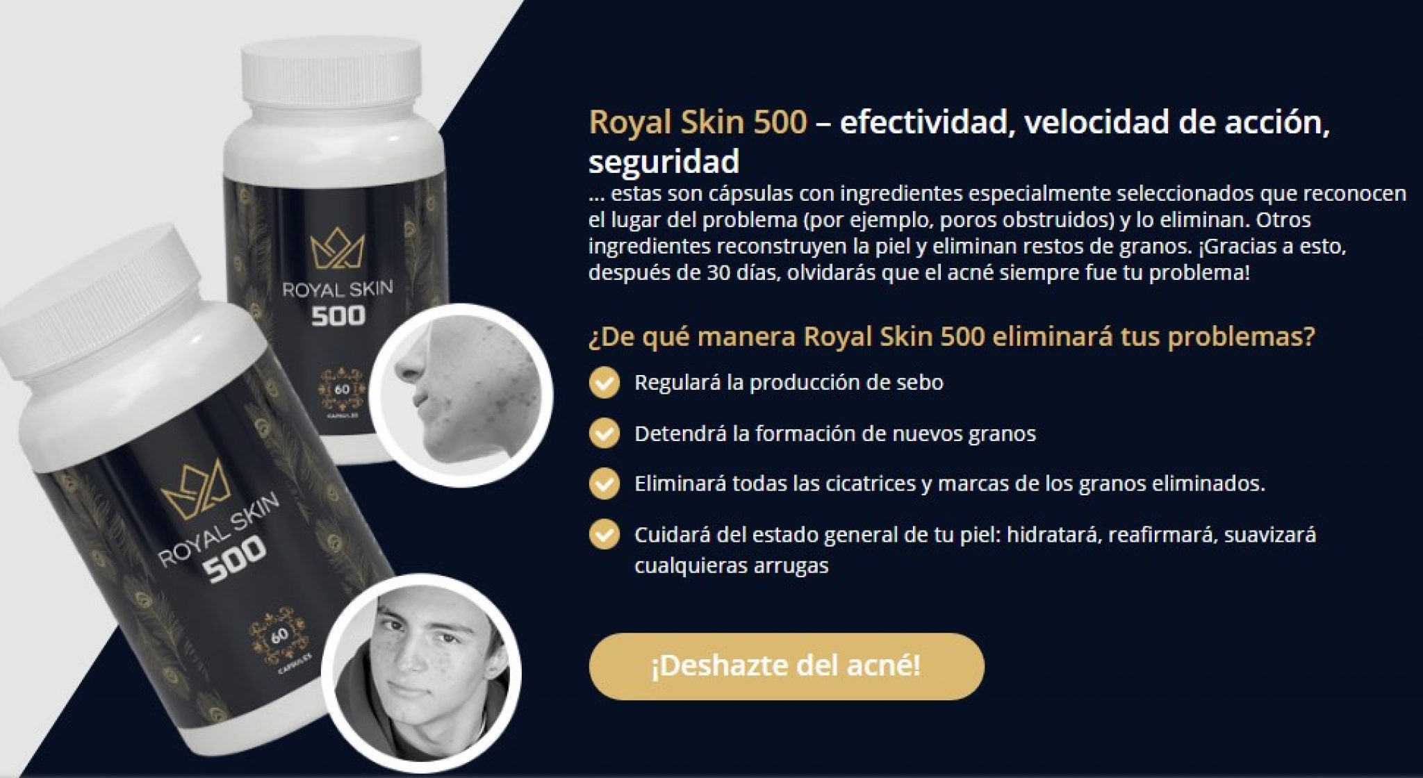 Royal Skin 500: olvidarás lo que era tener acné ¿Dónde comprar? ¿Precio ...
