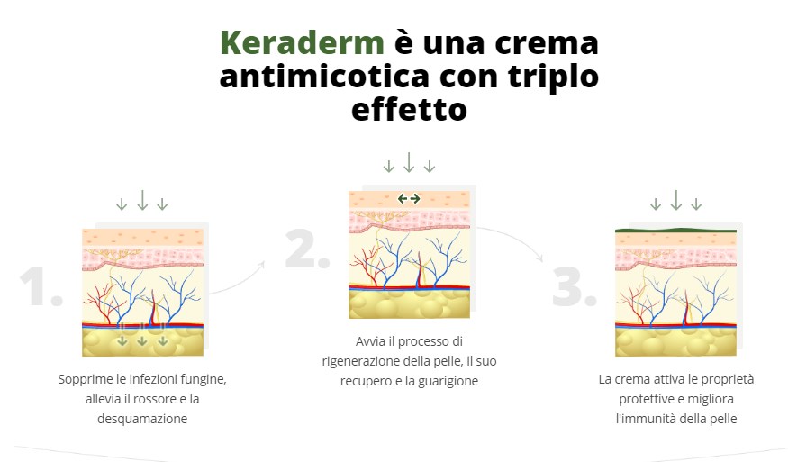 Keraderm - come funziona, recensioni vere, opinioni, prezzo, farmacia ...