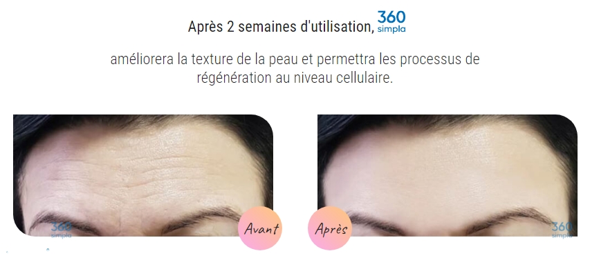 Avis Simpla 360 sérum régénérant cutané, acheter, prix en pharmacie ...
